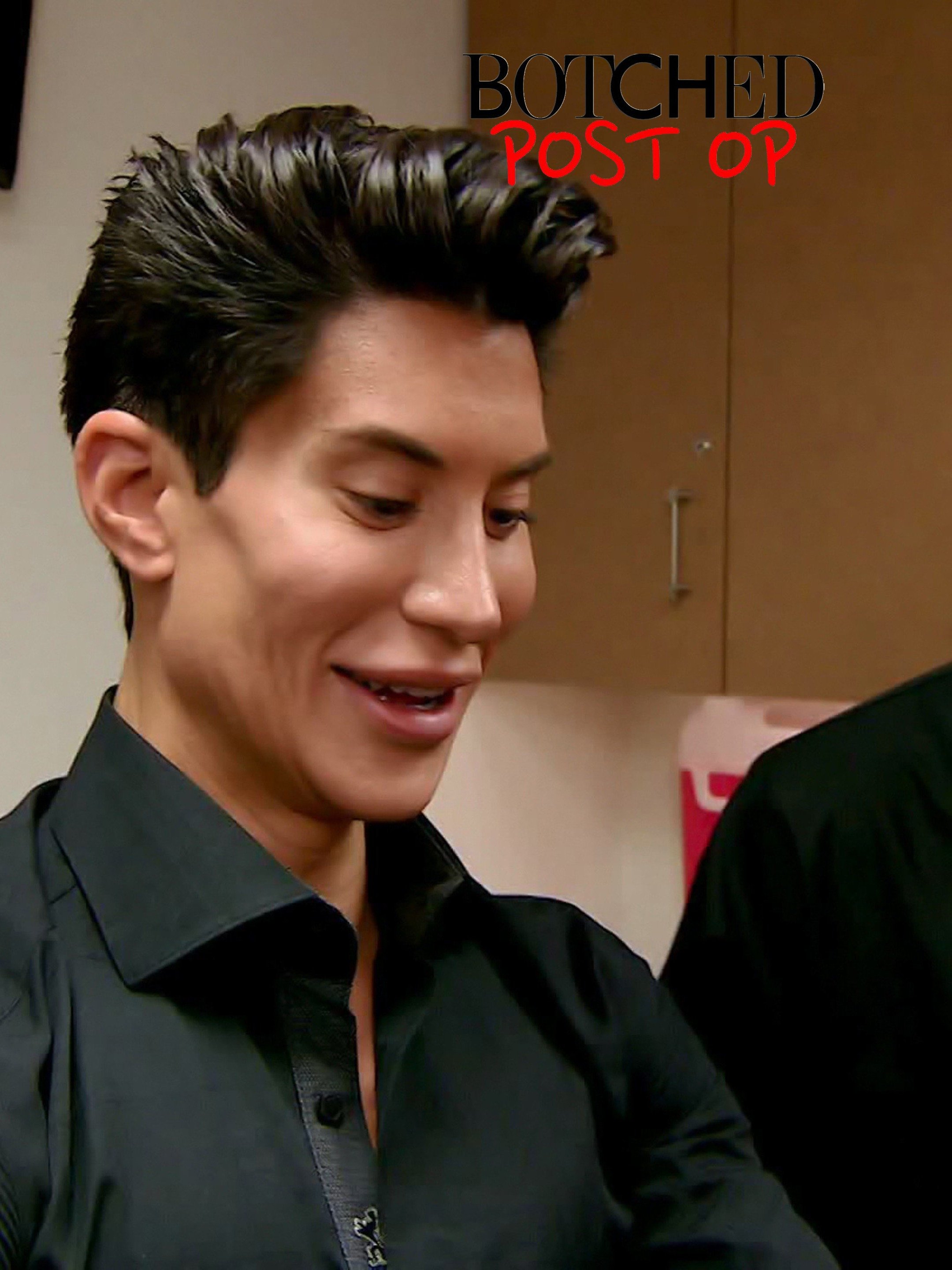 Botched: Post Op - Rotten Tomatoes