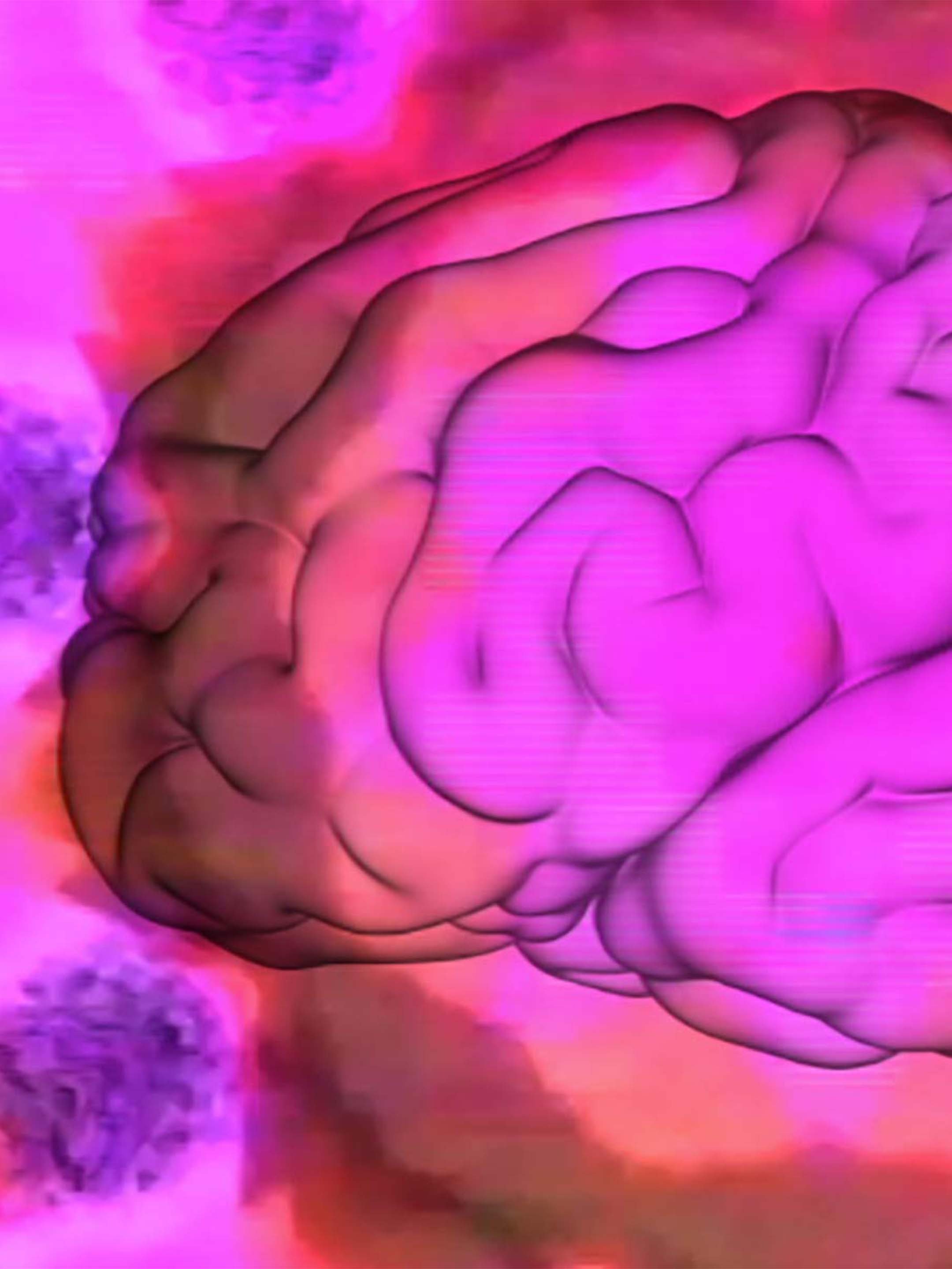 Brain Taco Module Pictures - Rotten Tomatoes